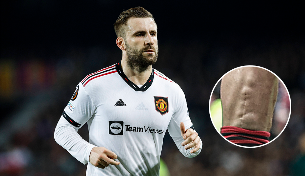 Luke Shaw: Man United defender explained how he “nearly lost his leg ...
